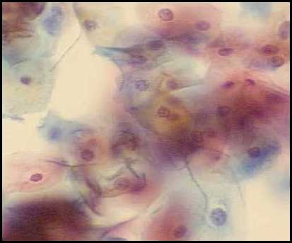 Gyn Cytopathology