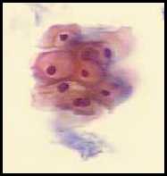Gyn Cytopathology