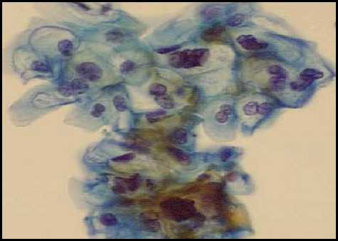 Gyn Cytopathology