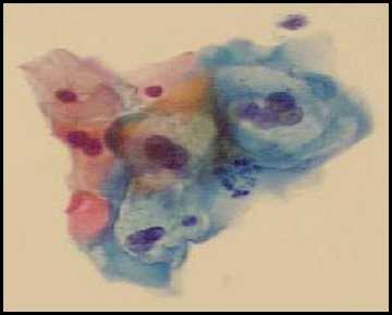 Gyn Cytopathology